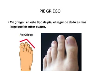 EVALUACIÓN DEL PIE (6).pdf descripción tipos | PDF