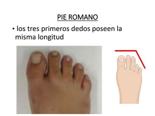 EVALUACIÓN DEL PIE (6).pdf descripción tipos | PDF