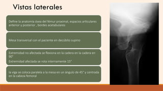 Evaluación radiografía de la cadera. para todos pptx | PPTX