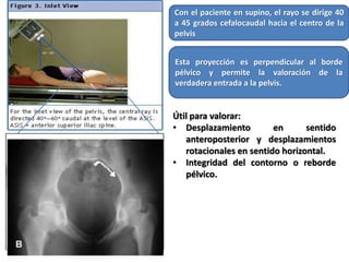 Evaluación Radiográfica De La Pelvis Pptx