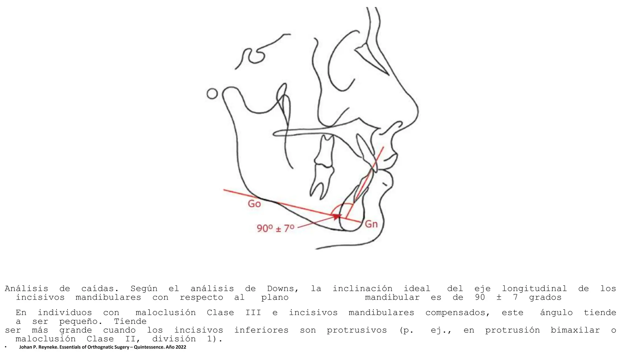 Evaluacion cefalometrica lateral para cirugía Ortognatica | PPTX