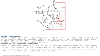 Evaluacion cefalometrica lateral para cirugía Ortognatica | PPTX
