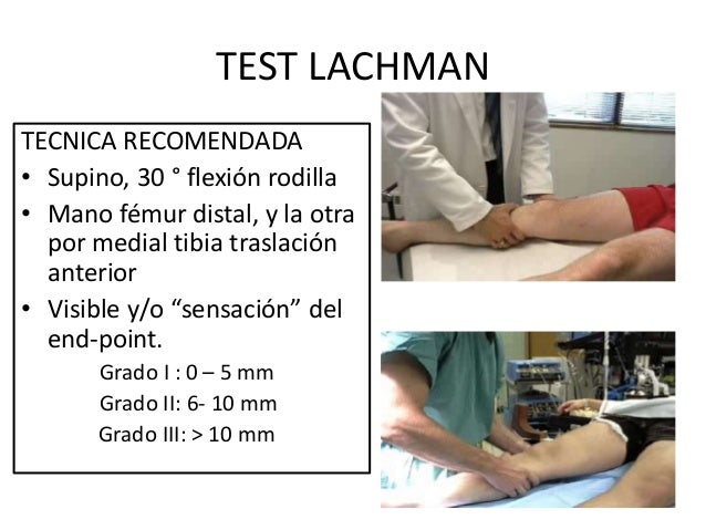 Evaluacion clinica del lca ateneo 2014