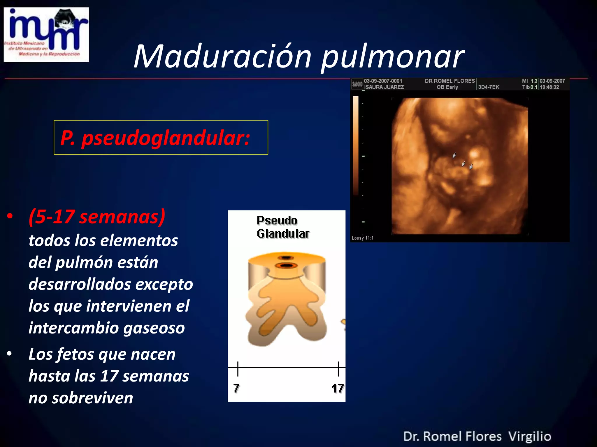 Evaluacion del torax fetal por ultrasonido. dr. romel flores | PPT