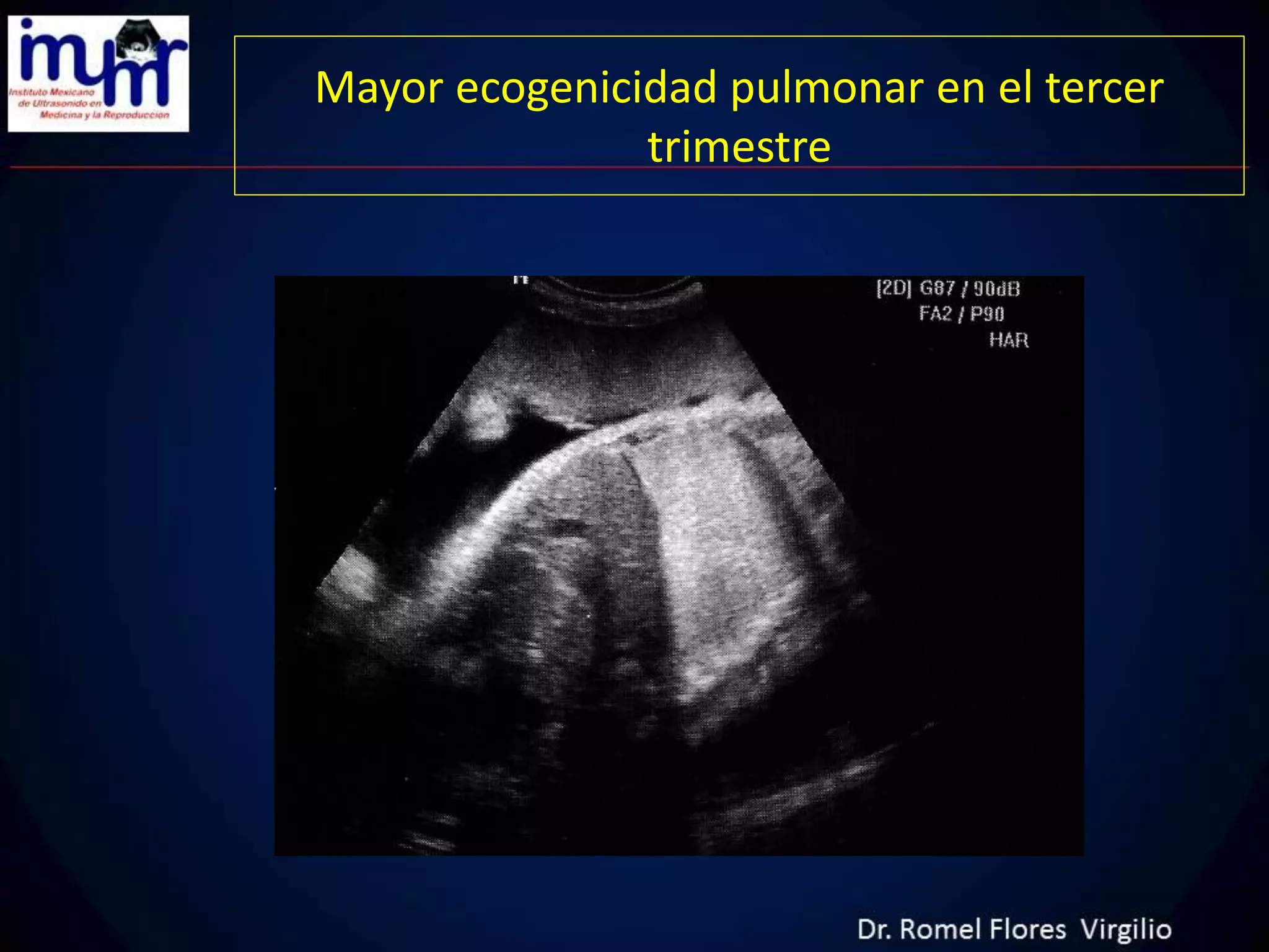 Evaluacion del torax fetal por ultrasonido. dr. romel flores | PPT