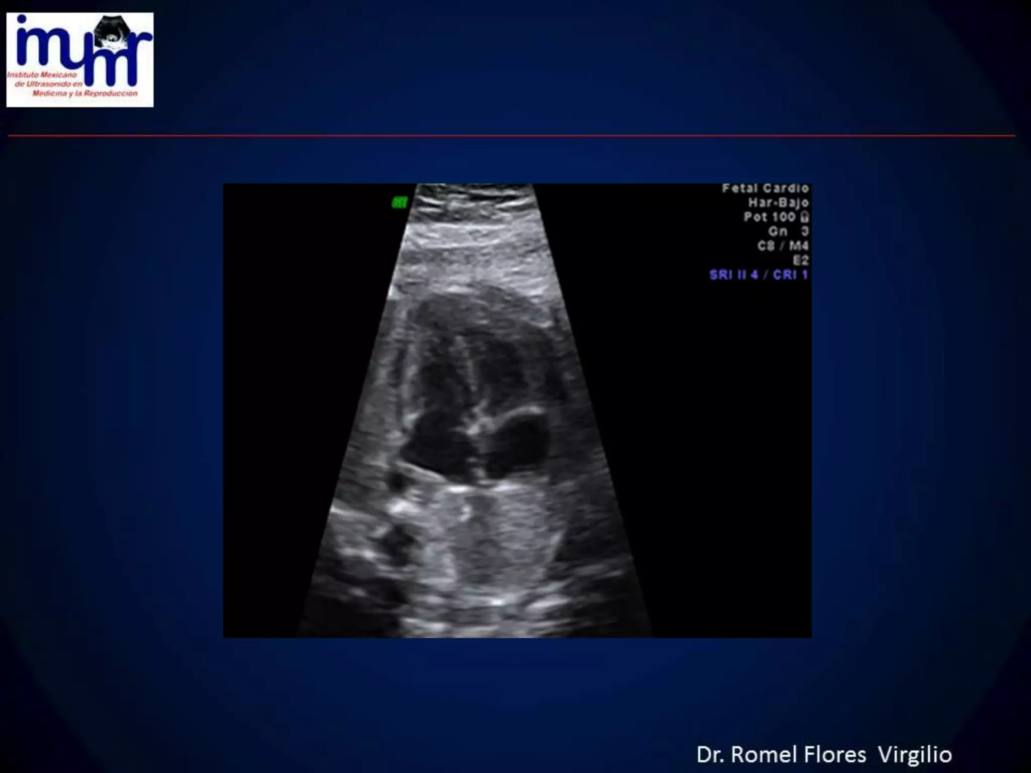 Evaluacion del torax fetal por ultrasonido. dr. romel flores | PDF ...