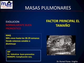 Evaluacion del torax fetal por ultrasonido. dr. romel flores | PDF