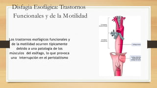 Evaluacion de sintomas esofagicos T.pptx