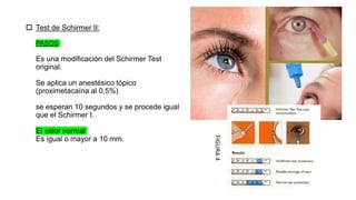 EVALUACION LAGRIMAL ALONSO EXPOSICION.pptx