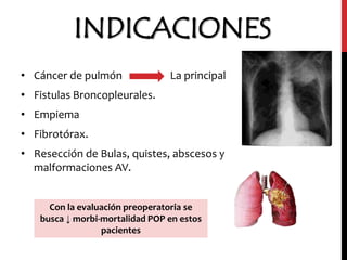 Evaluación preoperatoria cirugía de resección pulmonar | PPTX