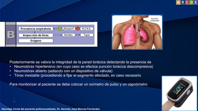 Evaluación primaria (ABCDE) | PPT Evaluación primaria (ABCDE) | PPT