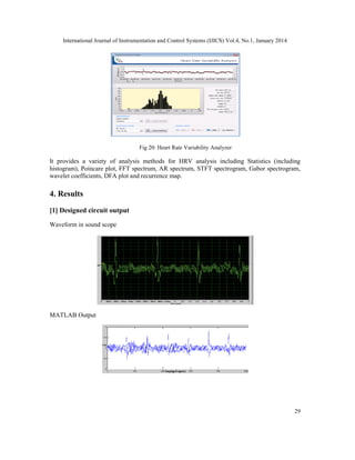 Evaluating ECG Capturing Using Sound-Card of PC/Laptop | PDF