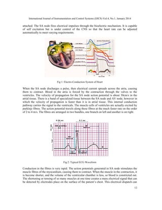 Evaluating ECG Capturing Using Sound-Card of PC/Laptop | PDF