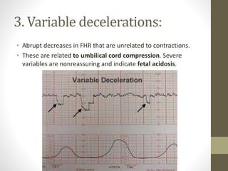 Evaluating of fetal heart tracing | PPTX