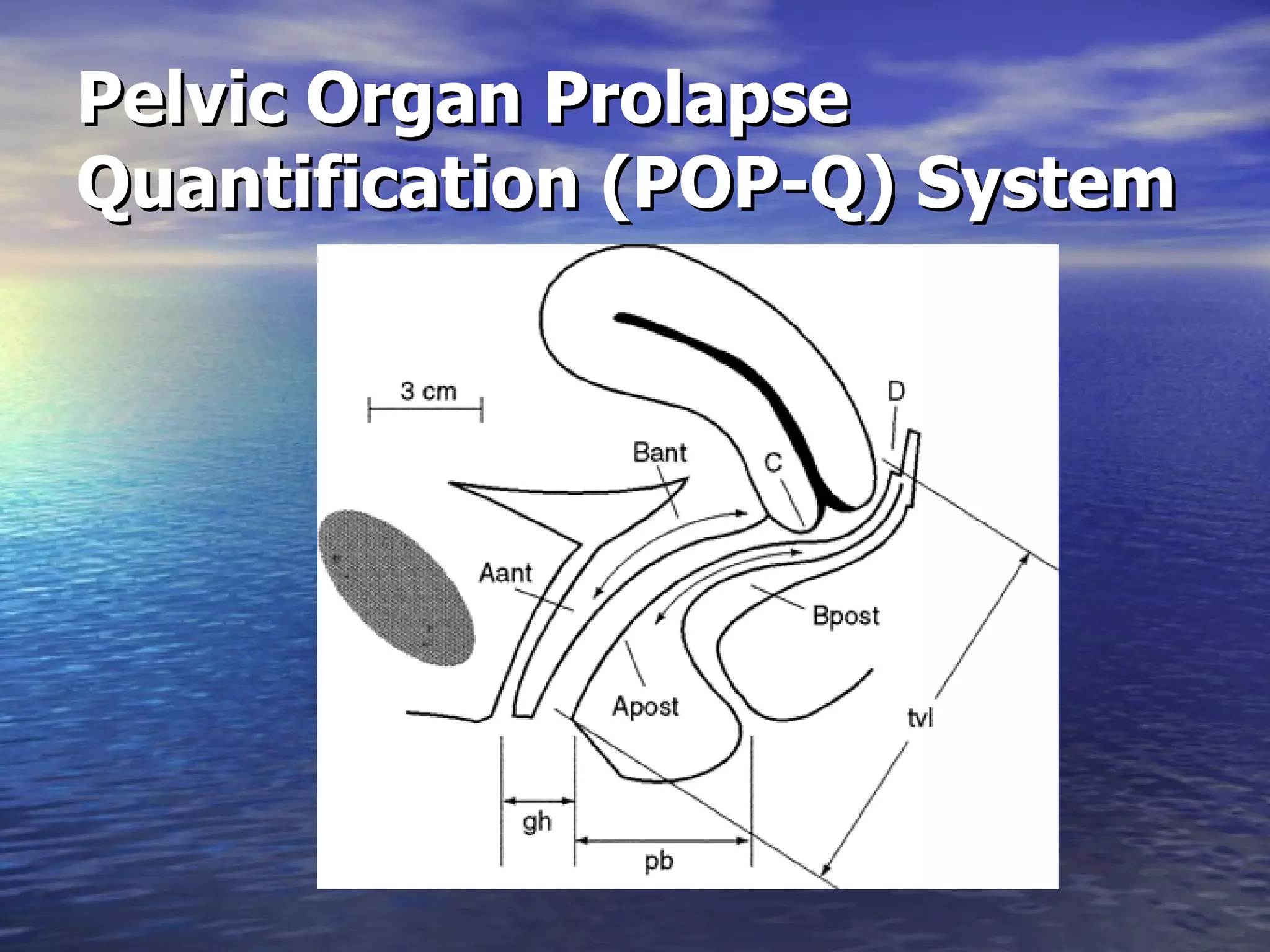 Evaluation Management of Genital Prolapse - www.jinekolojivegebelik.com
