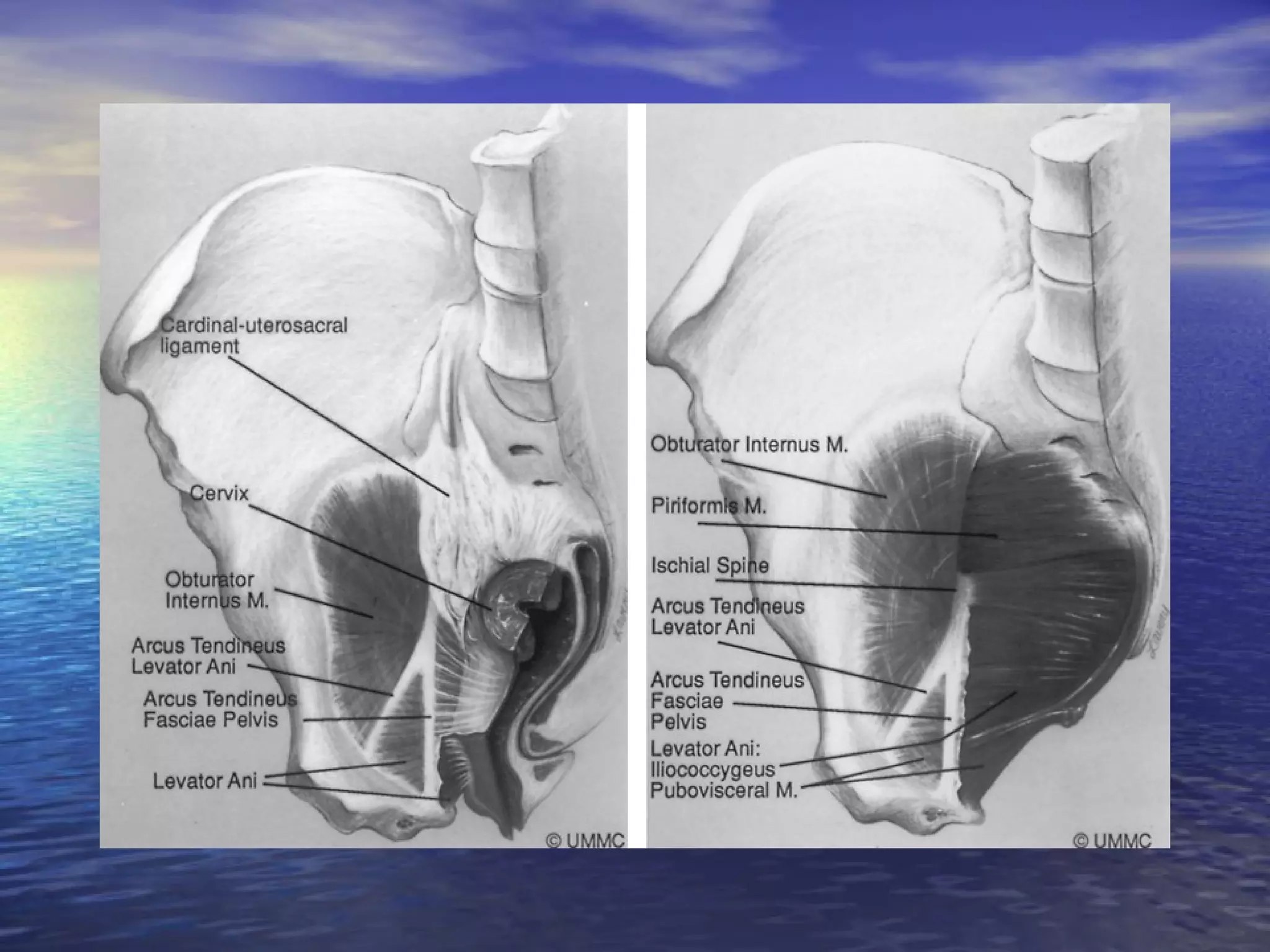 Evaluation Management of Genital Prolapse - www.jinekolojivegebelik.com