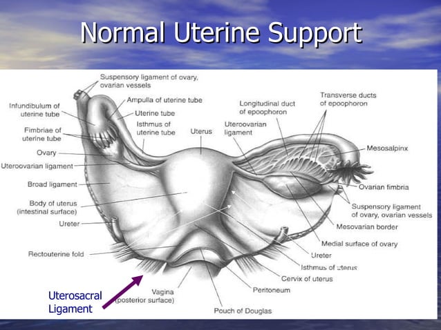 Evaluation Management of Genital Prolapse - www.jinekolojivegebelik.com