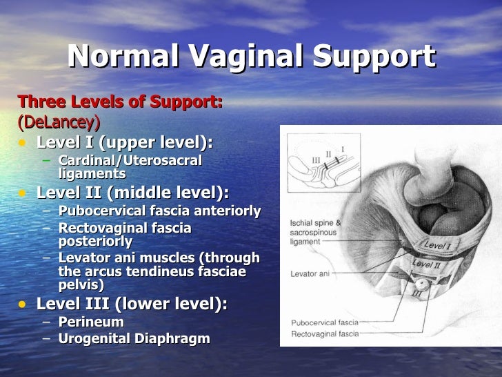 Evaluation Management of Genital Prolapse - www.jinekolojivegebelik.c…