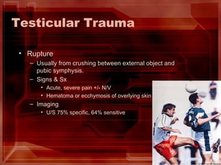 Evaluation of Testicular Pain | PPT