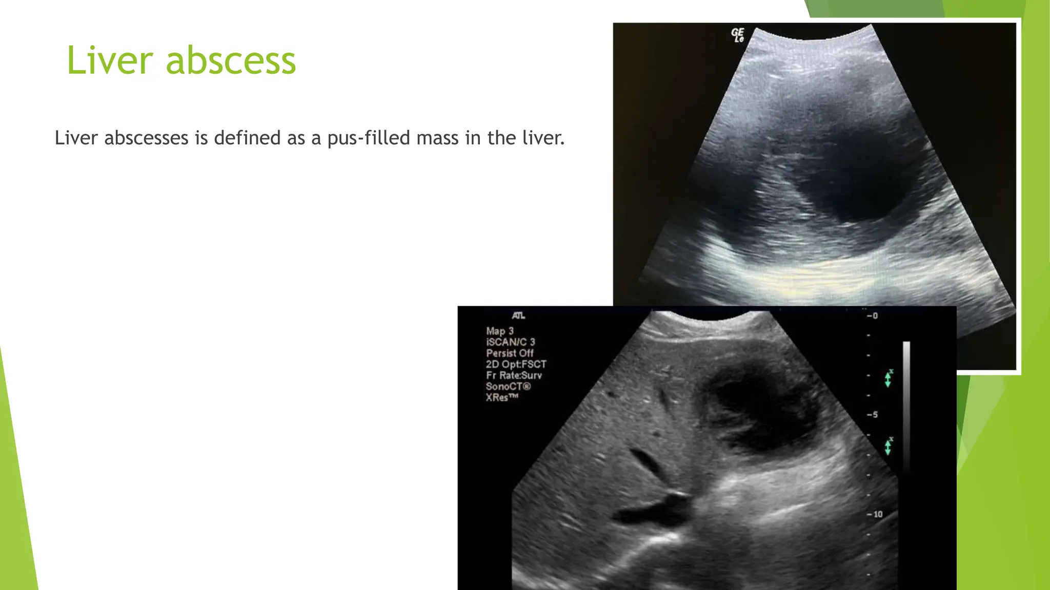 Evaluation abdominal Point of care ultrasonography (POCUS)is advanced ...