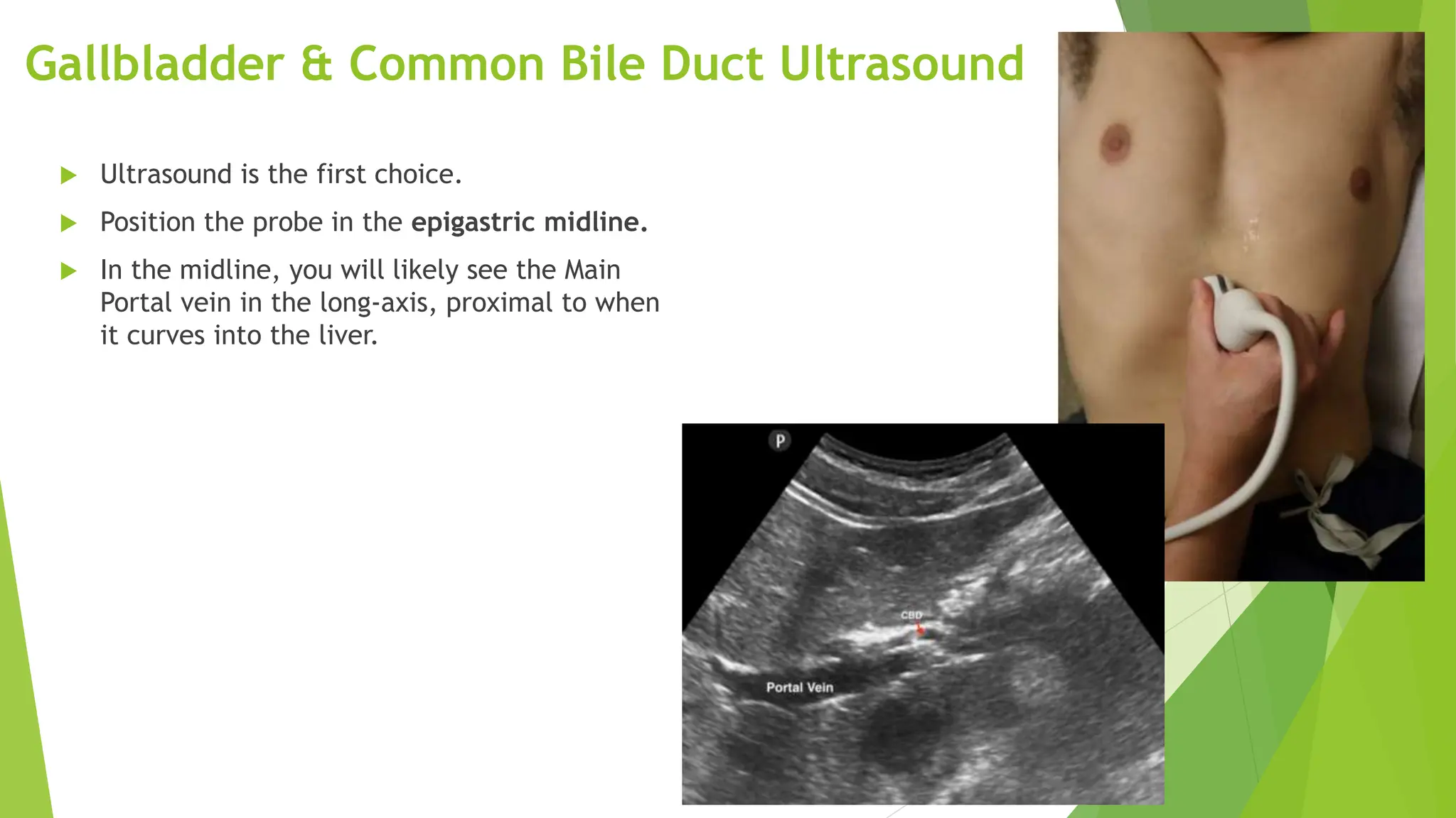 Evaluation abdominal Point of care ultrasonography (POCUS)is advanced ...