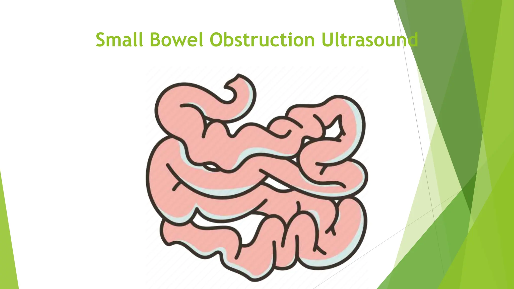 Evaluation abdominal Point of care ultrasonography (POCUS)is advanced ...