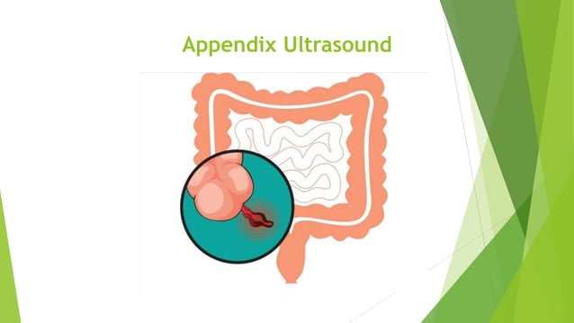 Evaluation abdominal Point of care ultrasonography (POCUS)is advanced ...