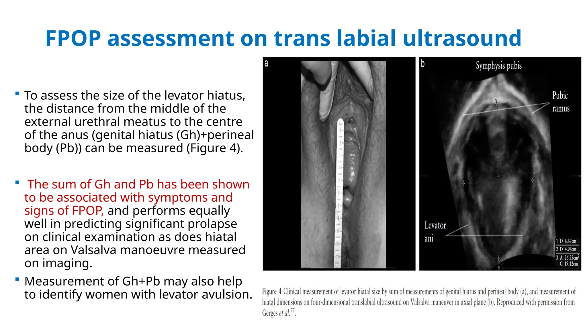 Evaluation and Decision Making in Pelvic Organ Prolapse | Comprehensive ...