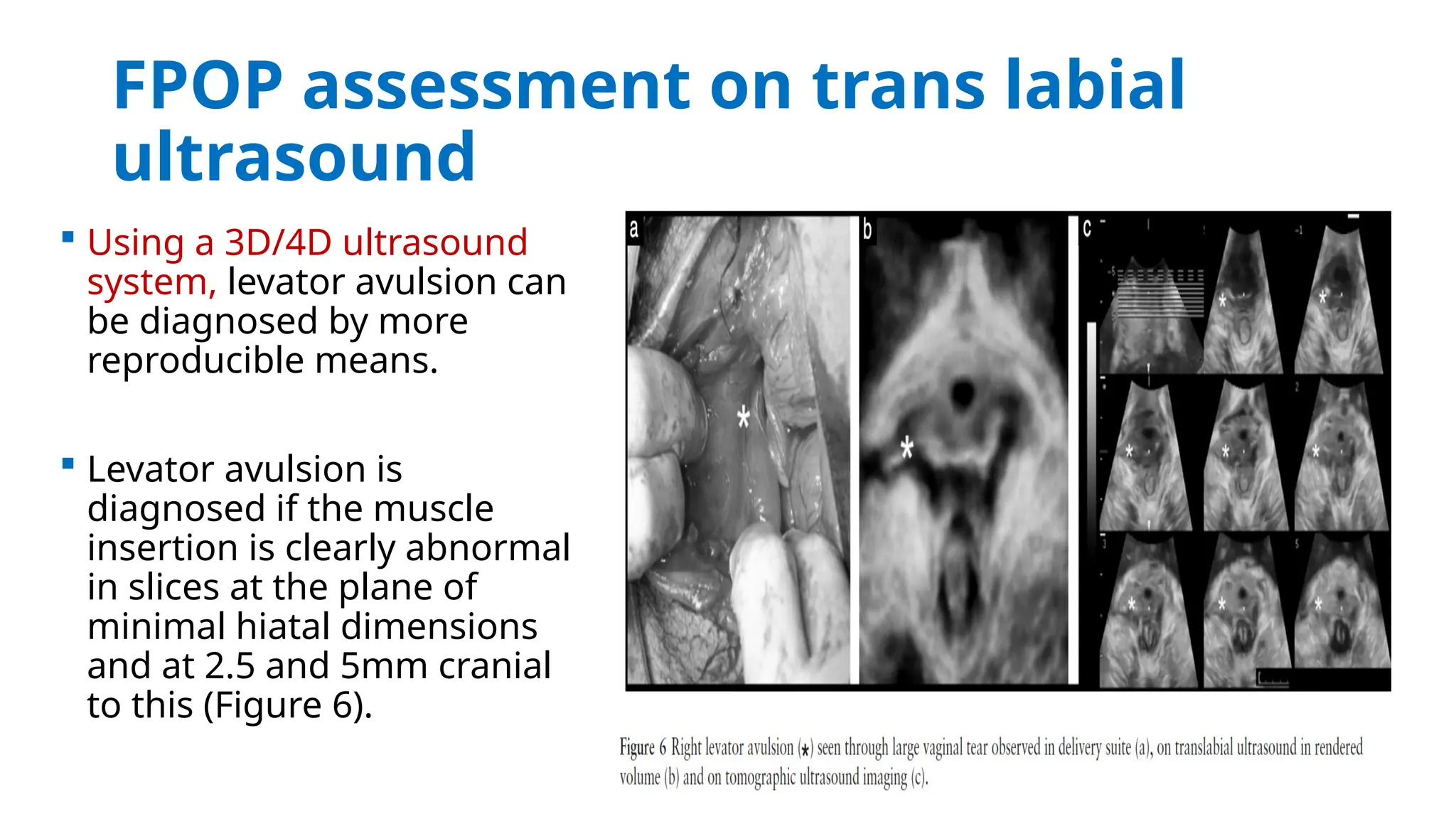 Evaluation and Decision Making in Pelvic Organ Prolapse | Comprehensive ...