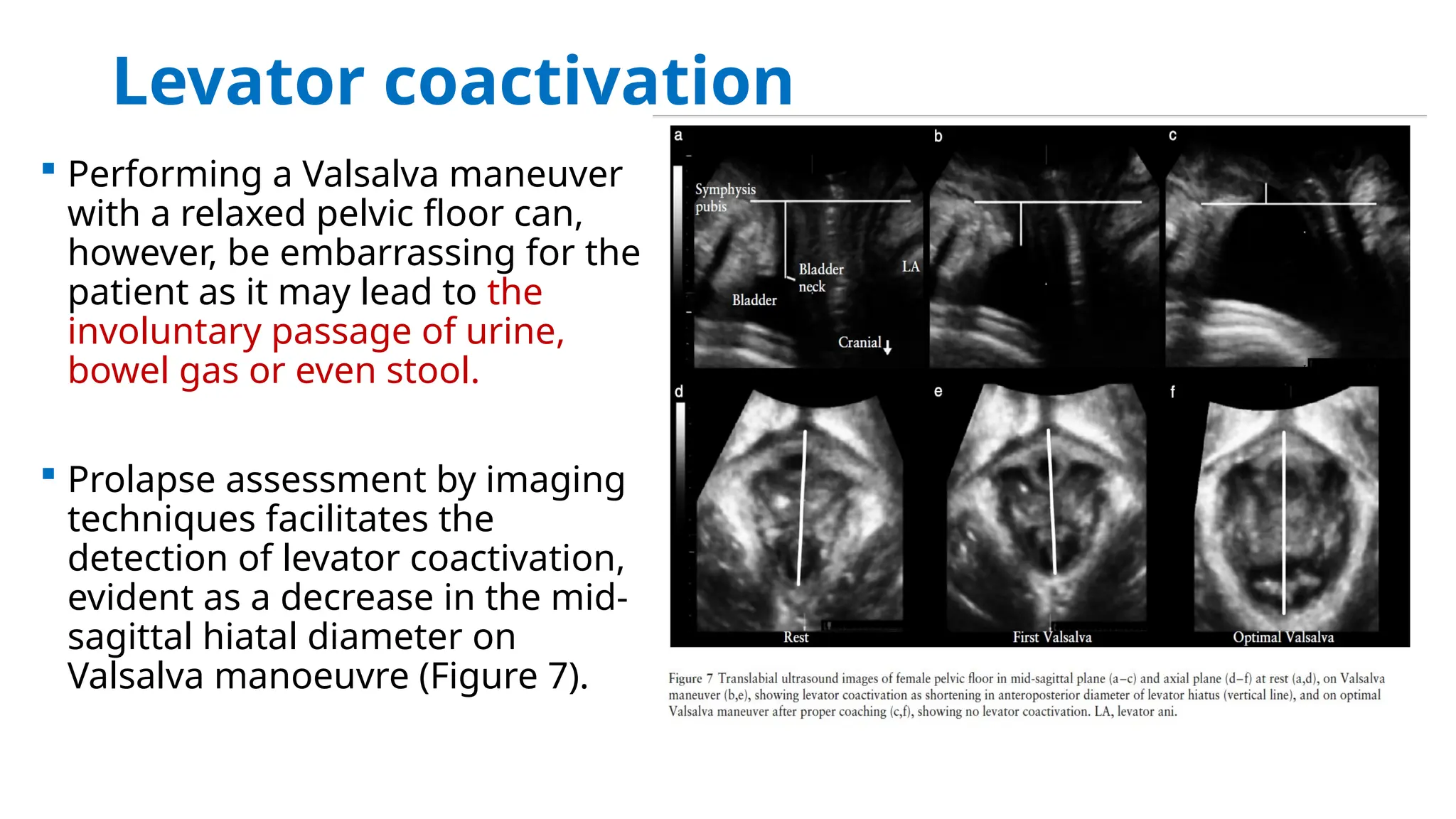 Evaluation and Decision Making in Pelvic Organ Prolapse | Comprehensive ...
