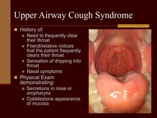 Post Nasal Drip Cobblestoning