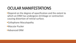 Evaluation and management of epiretinal membranes | PPTX
