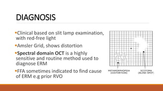 Evaluation and management of epiretinal membranes | PPTX