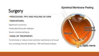 Evaluation and management of epiretinal membranes | PPTX