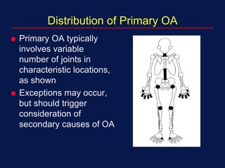 Evaluation and Management of Osteoarthritis (2).ppt