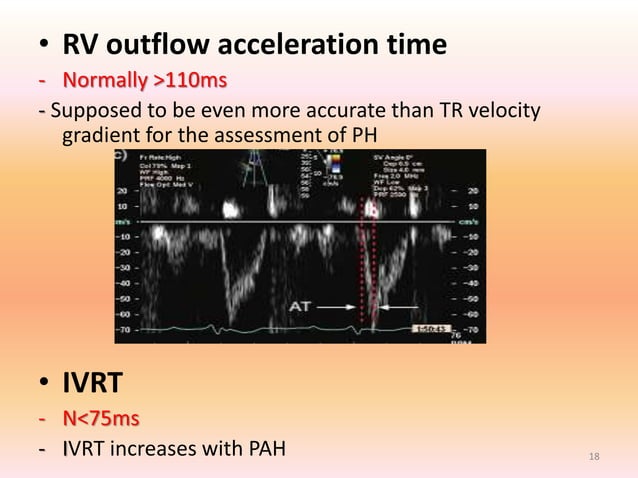 Evaluation and Management of pulmonary artery hypertension - dr sandeep ...
