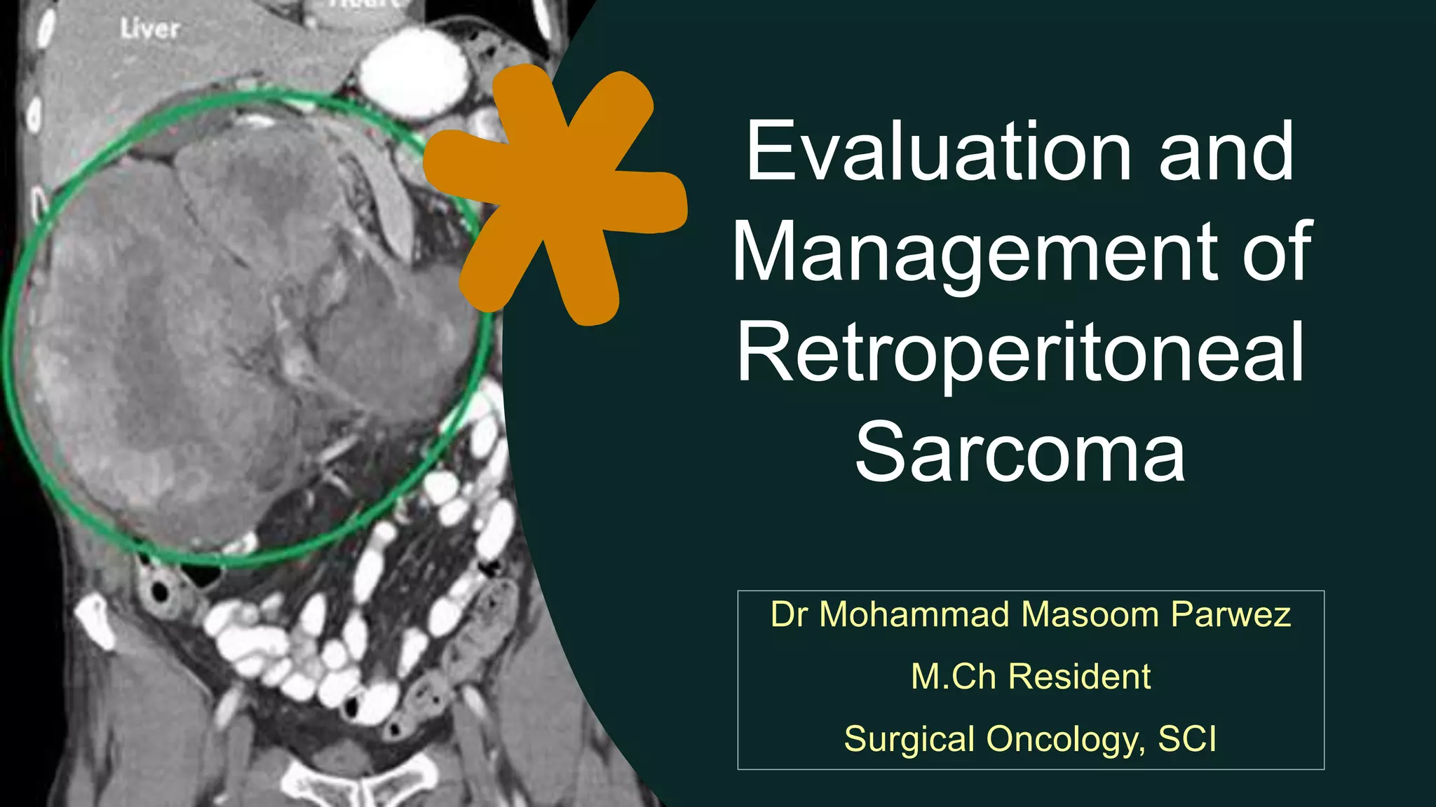 Evaluation and Management of Retroperitoneal Sarcoma.pptx