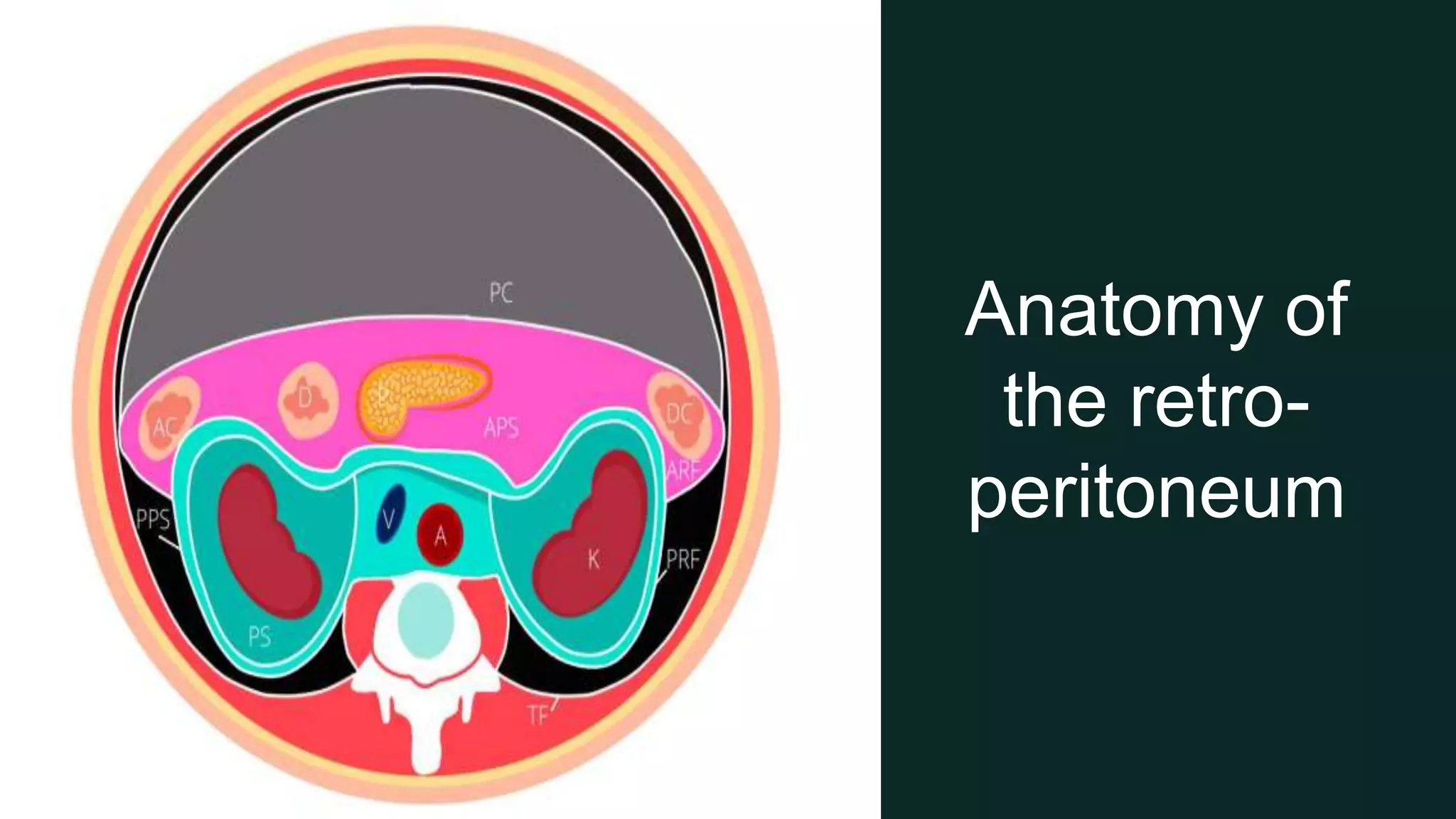 Evaluation and Management of Retroperitoneal Sarcoma.pptx