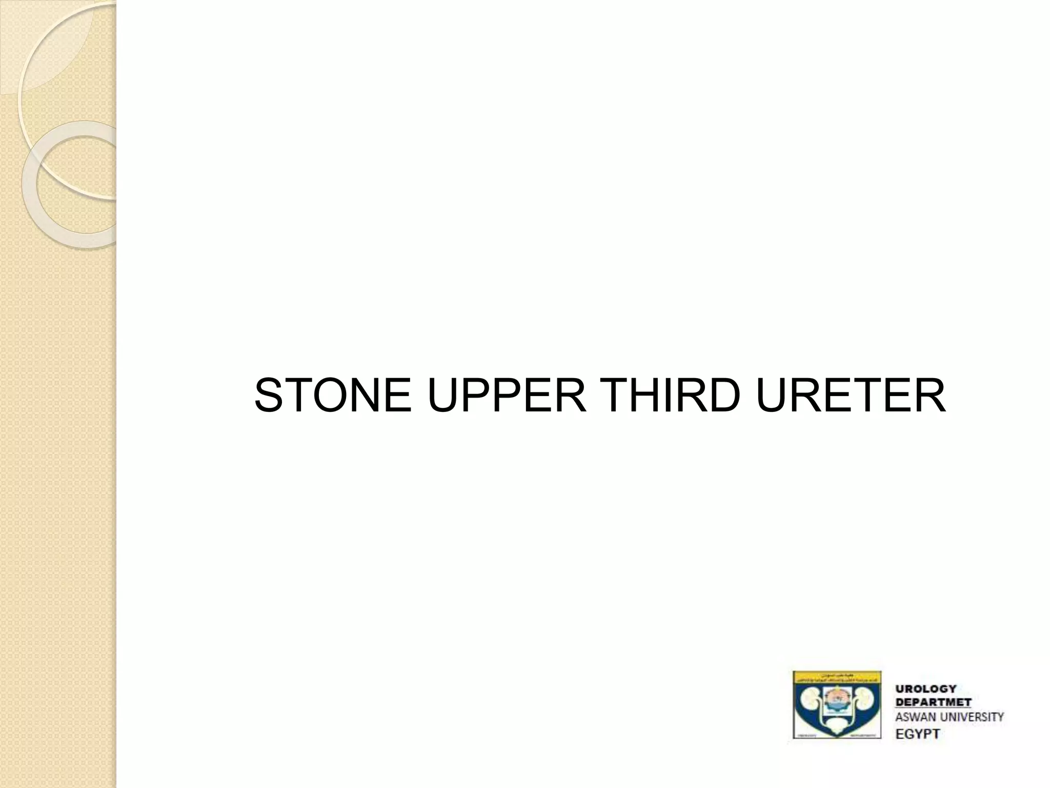 Evaluation and management of ureteric stones | PPTX