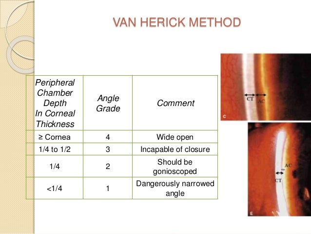 Evaluation of a glaucoma patient