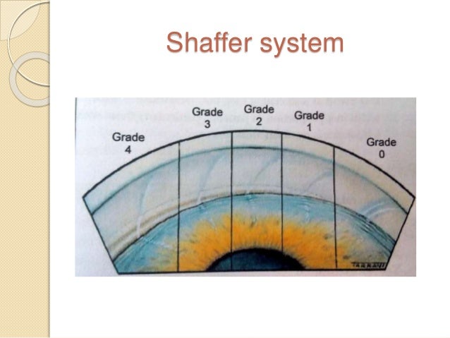 Evaluation of a glaucoma patient