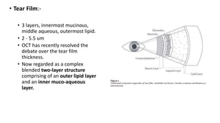 Evaluation of a patient of Dry Eye .pptx