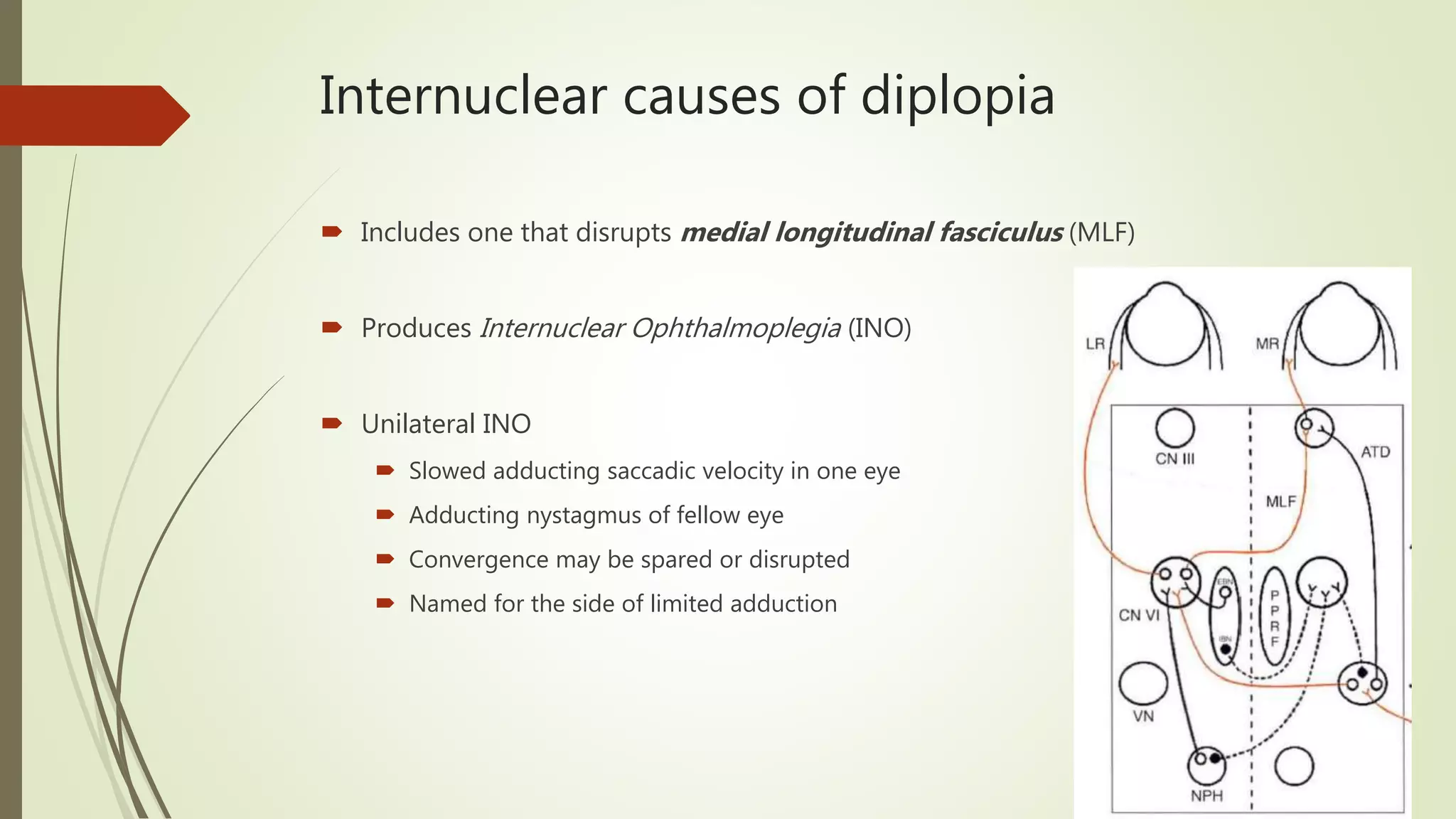 Evaluation of a patient with diplopia | PPTX | Eye and Vision ...