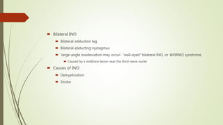 Evaluation of a patient with diplopia | PPTX