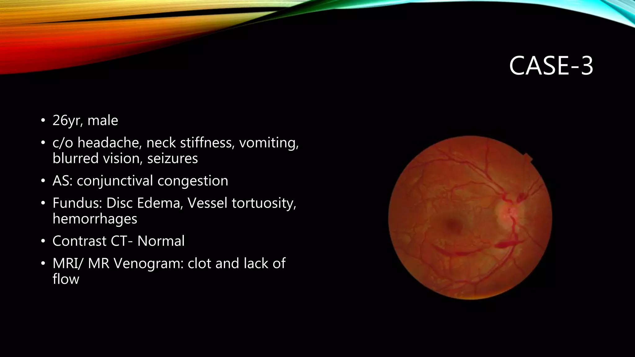 Evaluation of a patient with disc edema | PPTX