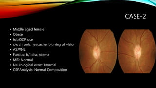 Evaluation of a patient with disc edema | PPTX