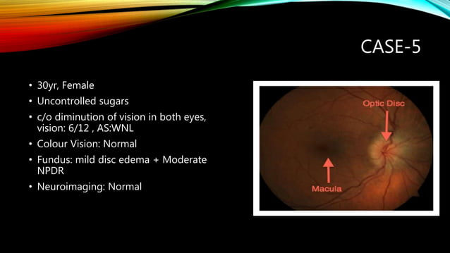 Evaluation of a patient with disc edema | PPTX