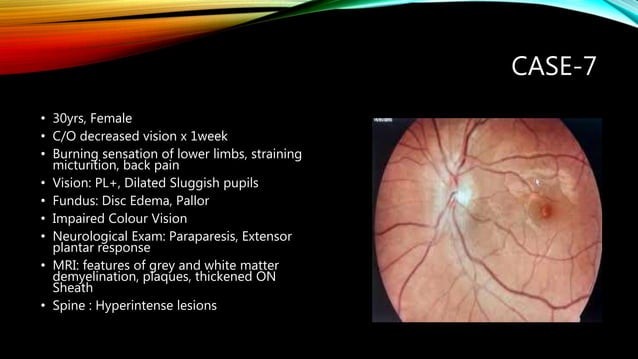 Evaluation of a patient with disc edema | PPTX