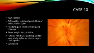 Evaluation of a patient with disc edema | PPTX