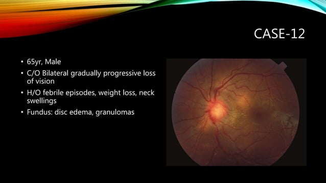 Evaluation of a patient with disc edema | PPTX